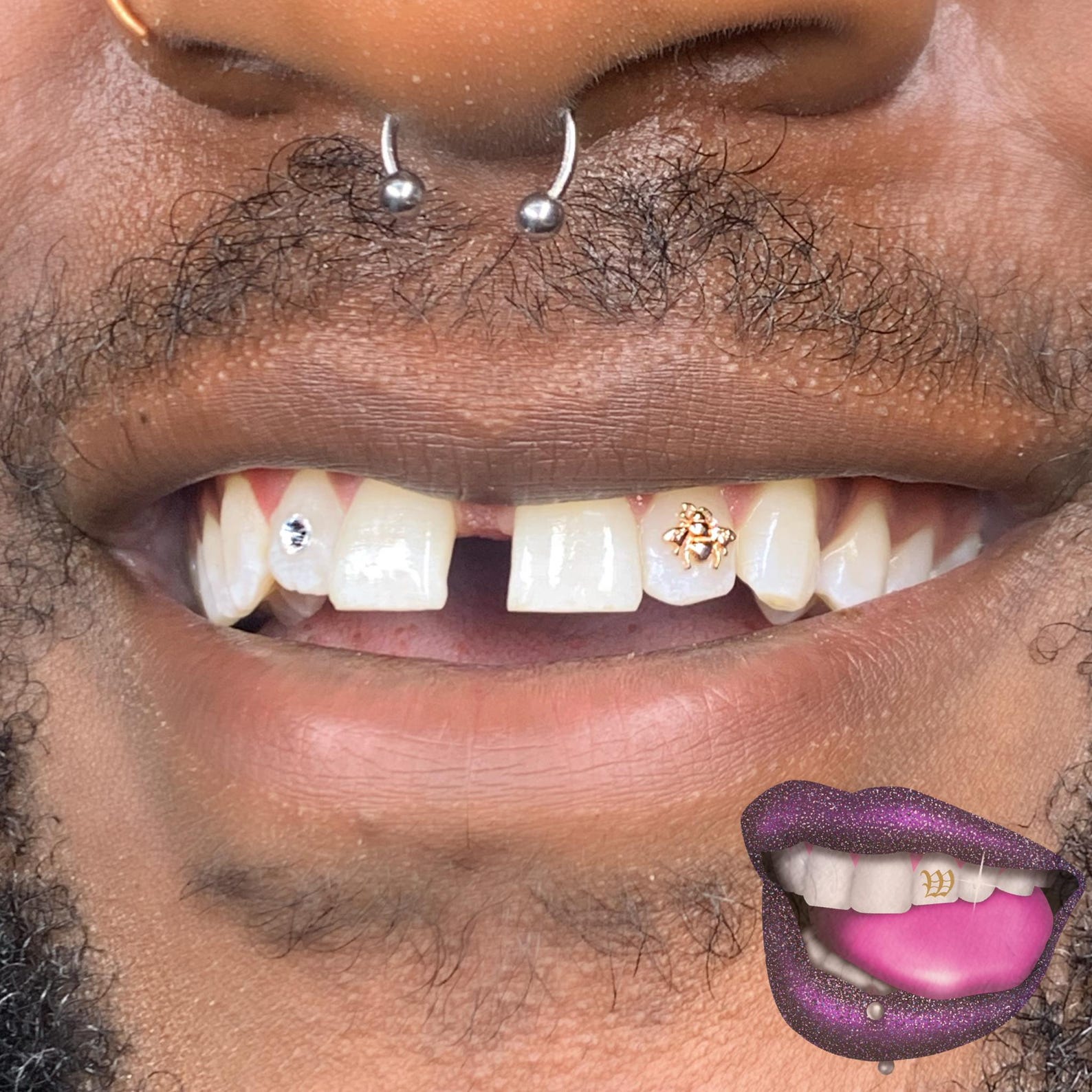 18k Gold LOGO Tooth Gems - Etsy