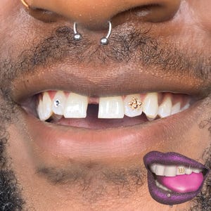 18k Gold LOGO Tooth Gems - Etsy