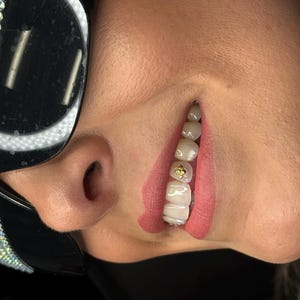 18k Gold LOGO Tooth Gems - Etsy