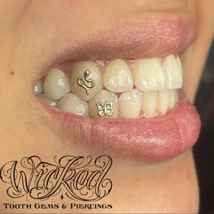 18k Gold LOGO Tooth Gems - Etsy
