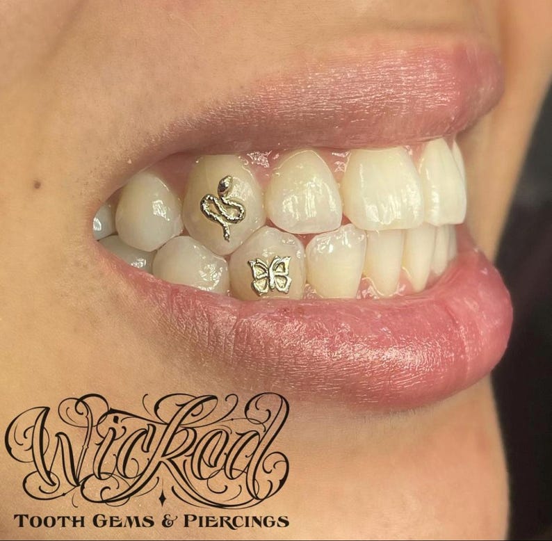 18k Gold LOGO Tooth Gems - Etsy
