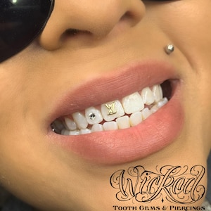 18k Gold LOGO Tooth Gems - Etsy