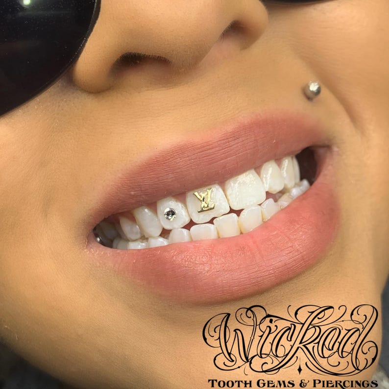 18k Gold LOGO Tooth Gems - Etsy