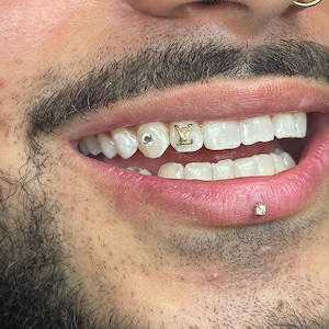 18k Gold LOGO Tooth Gems - Etsy