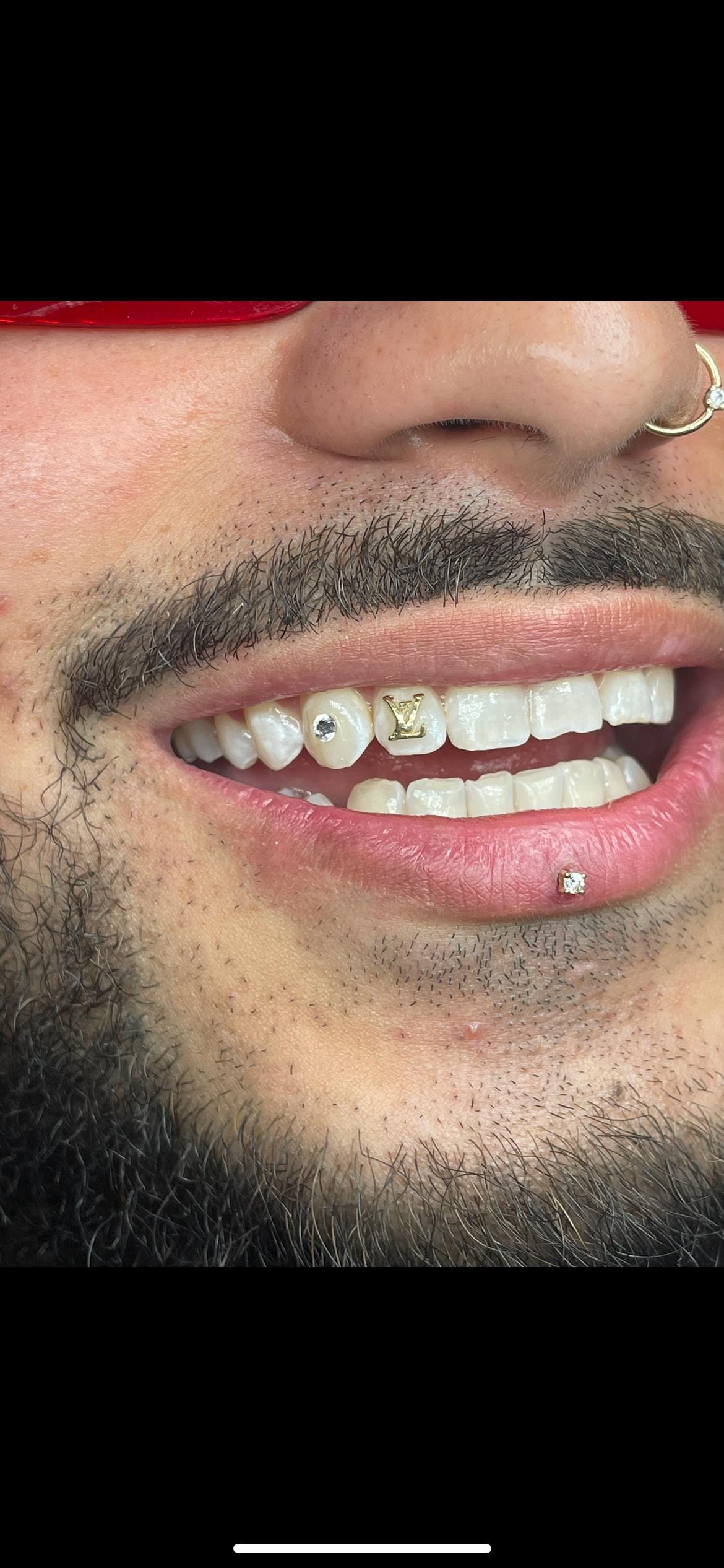 18k Gold LOGO Tooth Gems - Etsy
