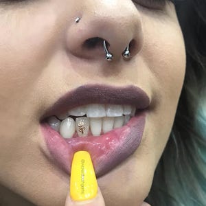 18k Gold Tooth Gems - Etsy