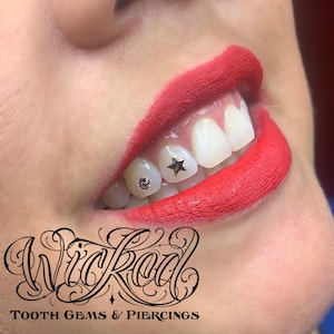 18k Gold Tooth Gems - Etsy