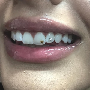 18k Gold Tooth Gems - Etsy