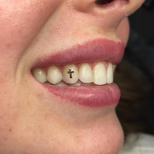 18k Gold Tooth Gems - Etsy