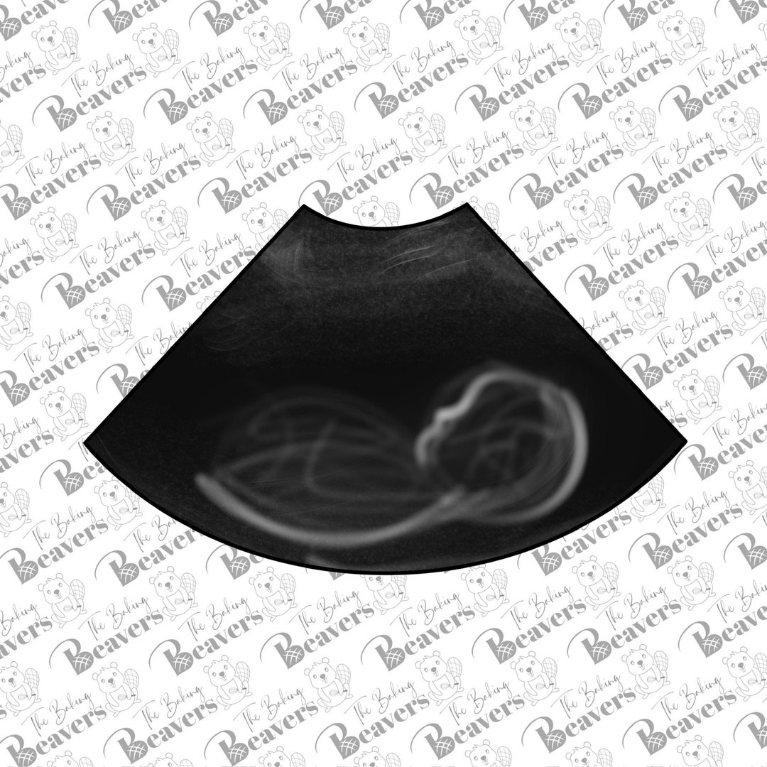 Ultrasound Cookie Cutter (recommend Sizing Up) - Etsy