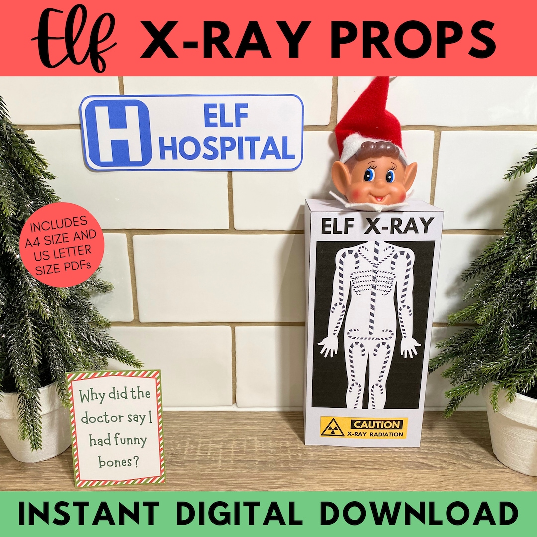 Printable Elf X-ray Props, Christmas Elf Doctor Scene, Xmas Elf Hospital Scene, Funny Elf Ideas ...