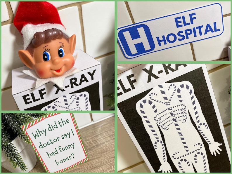 Printable Elf X-ray Props, Christmas Elf Doctor Scene, Xmas Elf ...