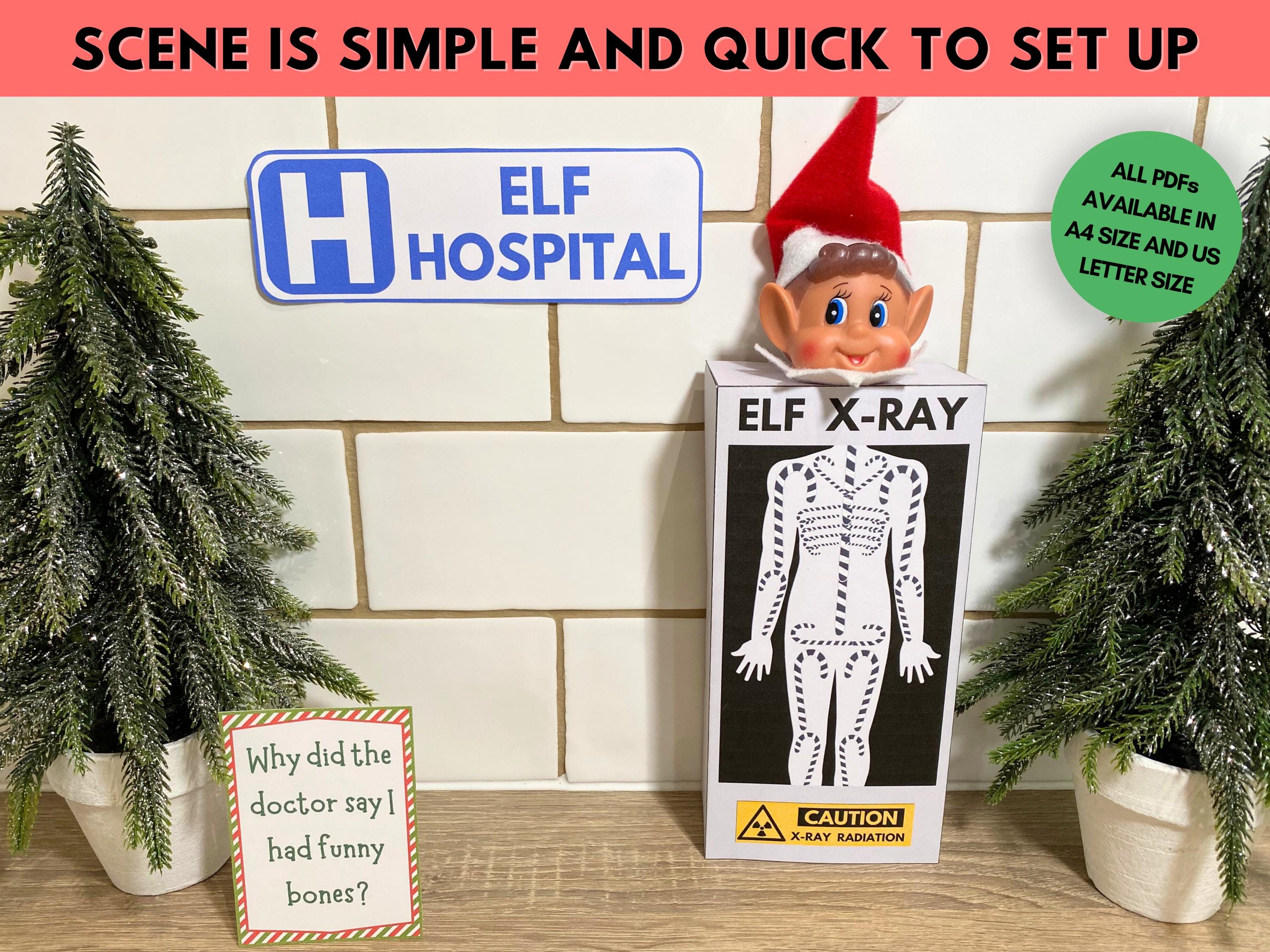 Printable Elf X-ray Props, Christmas Elf Doctor Scene, Xmas Elf ...