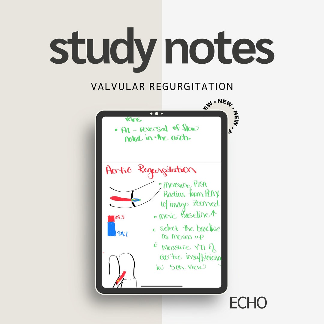 Sonography Notes Echocardiogram Study Guide Echo Tech Cheat Sheets ...