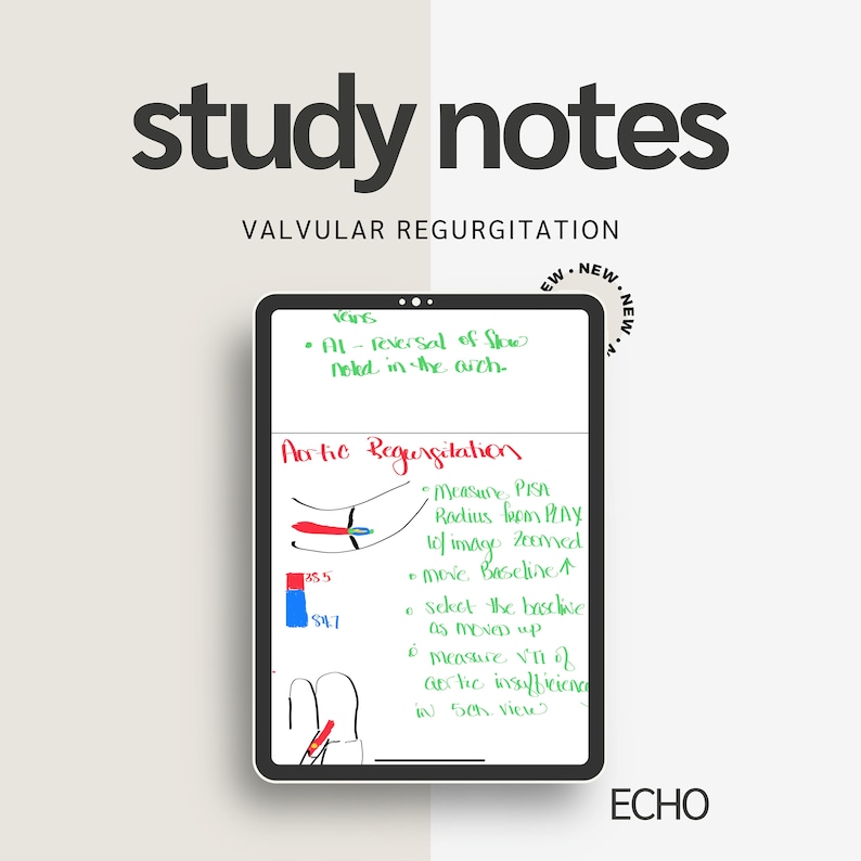 Sonography Notes Echocardiogram Study Guide Echo Tech Cheat Sheets ...