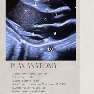 Echocardiography Made Simple Ebook How-to-guide Echo Book Echo Guide ...