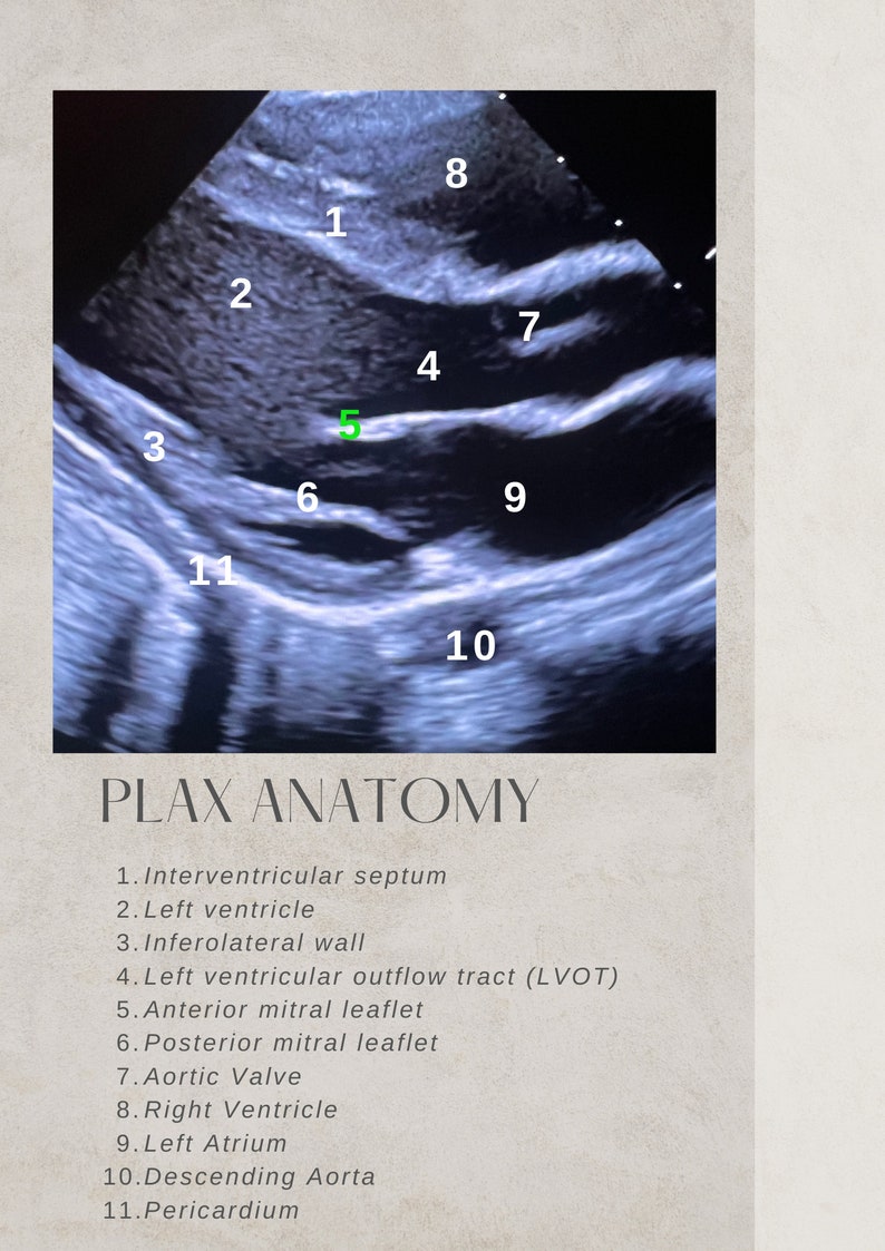 Echocardiography Made Simple Ebook How-to-guide Echo Book Echo Guide ...
