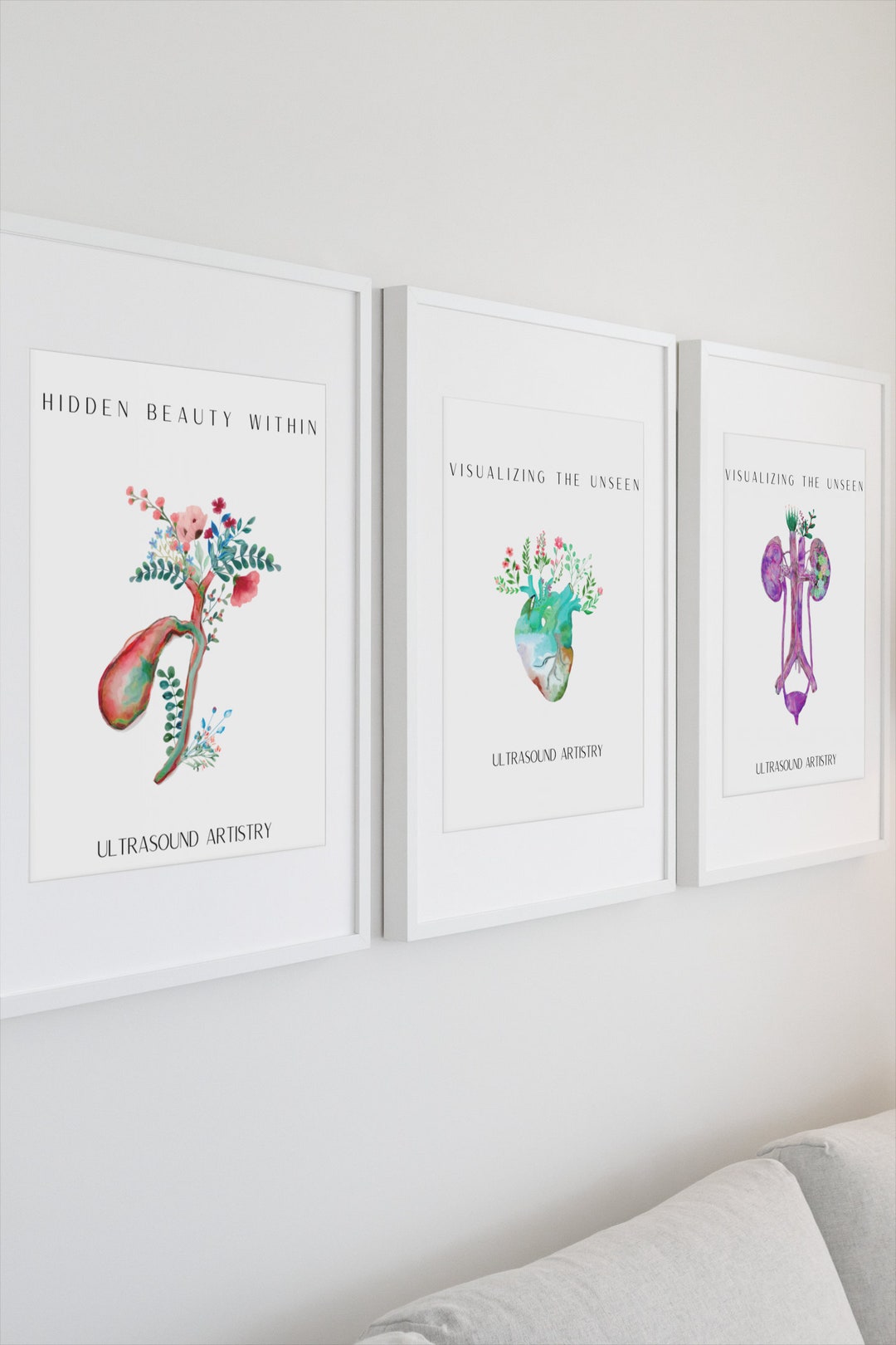 Sonography Wall Art Ultrasound Wall Art Ultrasound Tech Wall Decor ...