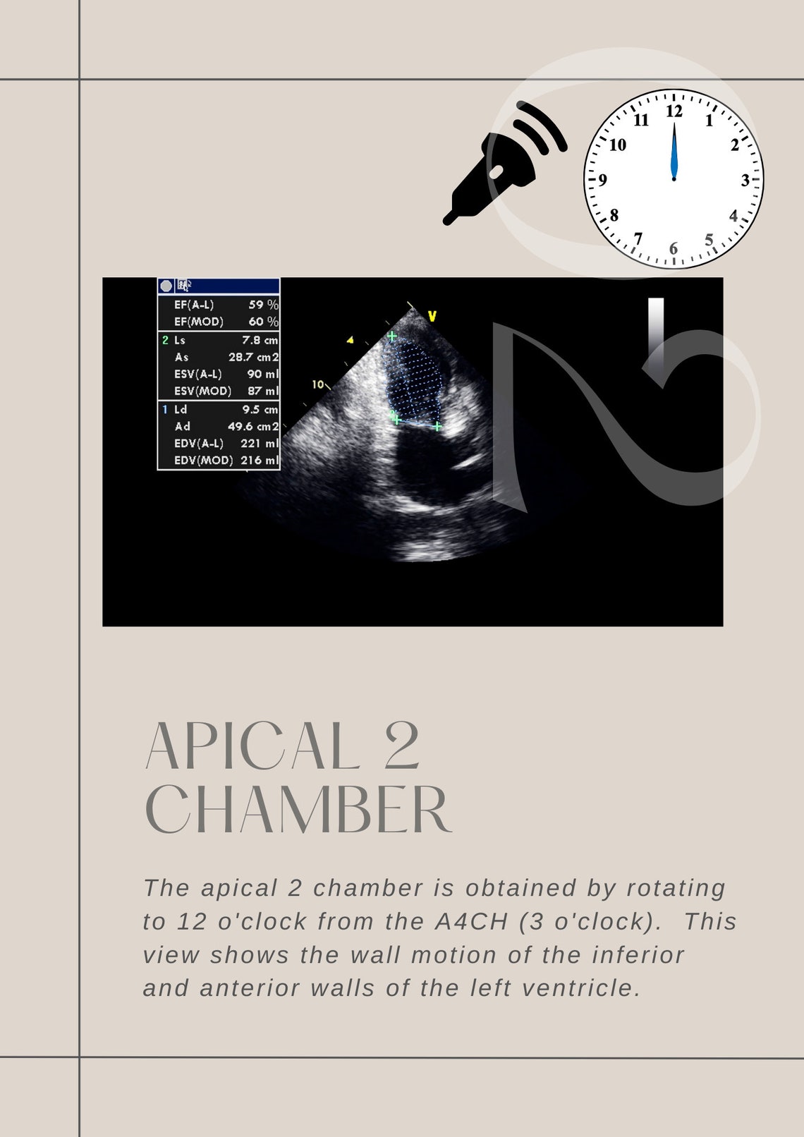 Echocardiography Made Simple Ebook How-to-guide Echo Book Echo Guide Echocardiography Echo Tech ...