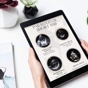 Echocardiography Beginners Guide Echo Ebook Echo Tech Echocardiography ...