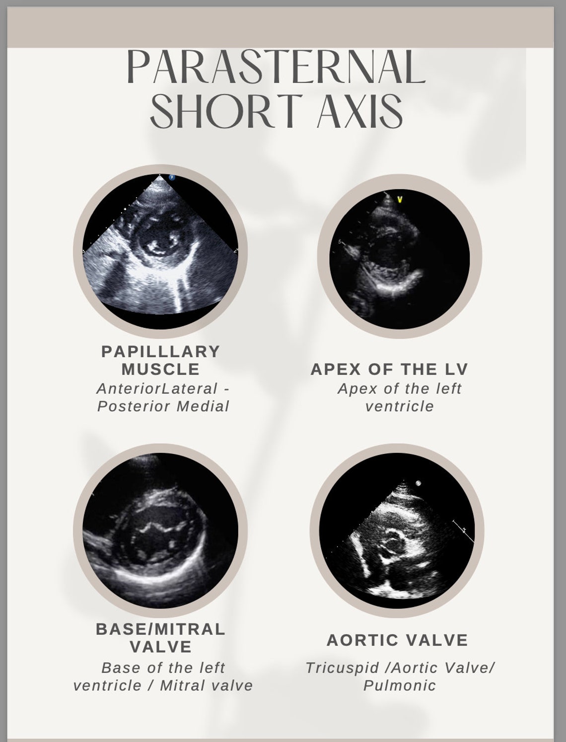 Echocardiography Beginners Guide/ Echo Ebook/ Echo Tech/ - Etsy