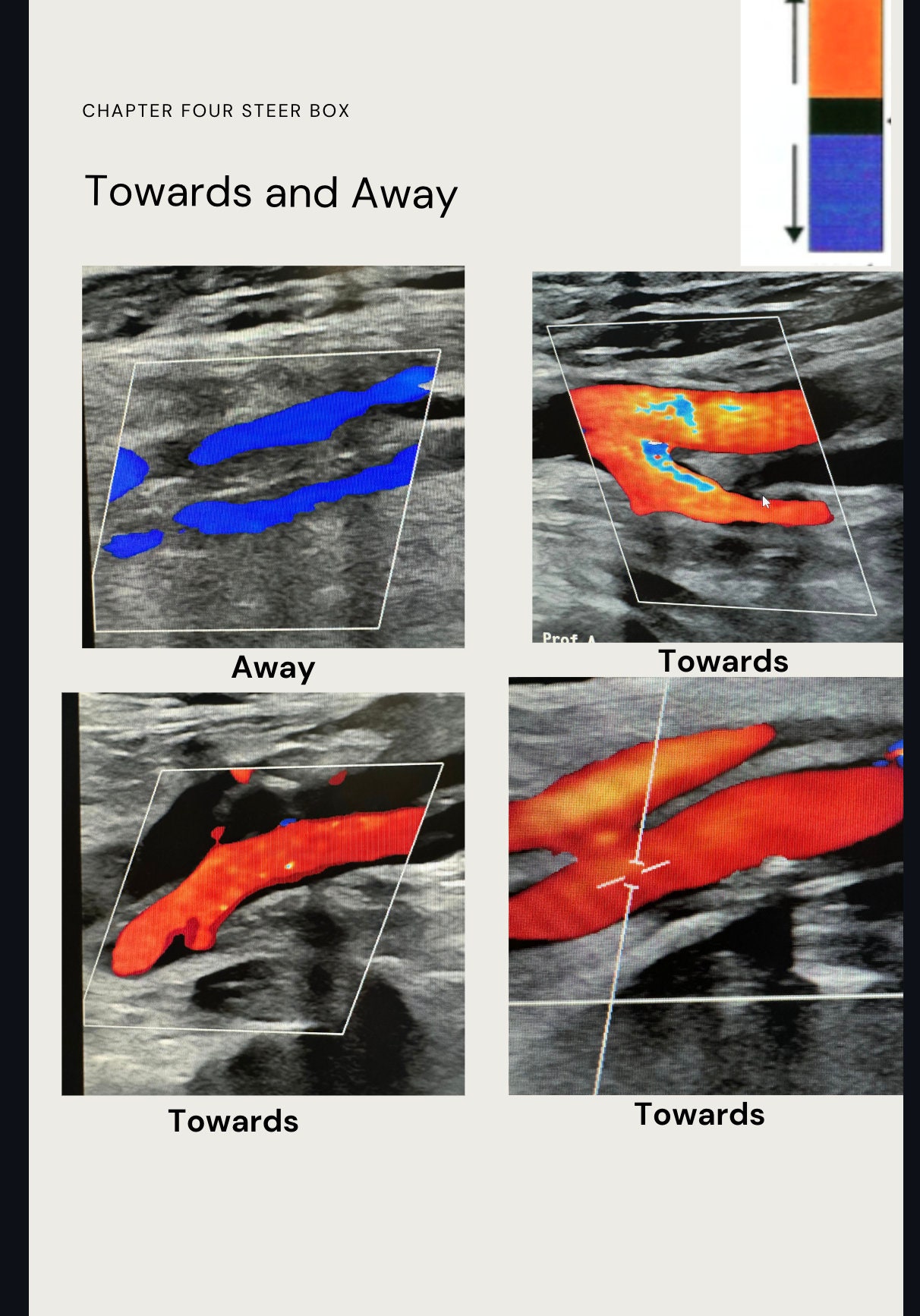 Vascular Ultrasound Color Doppler Ebook Ultrasound Study Guide Vascular ...