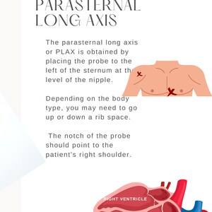 Echocardiography Made Simple Ebook How-to-guide Echo Book Echo Guide ...