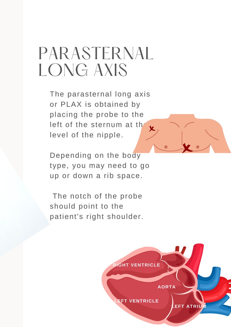 Echocardiography Made Simple Ebook How-to-guide Echo Book Echo Guide ...