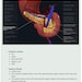 Ultrasound Abdomen Notes Pancreas Sonography Student Notes Ultrasound ...