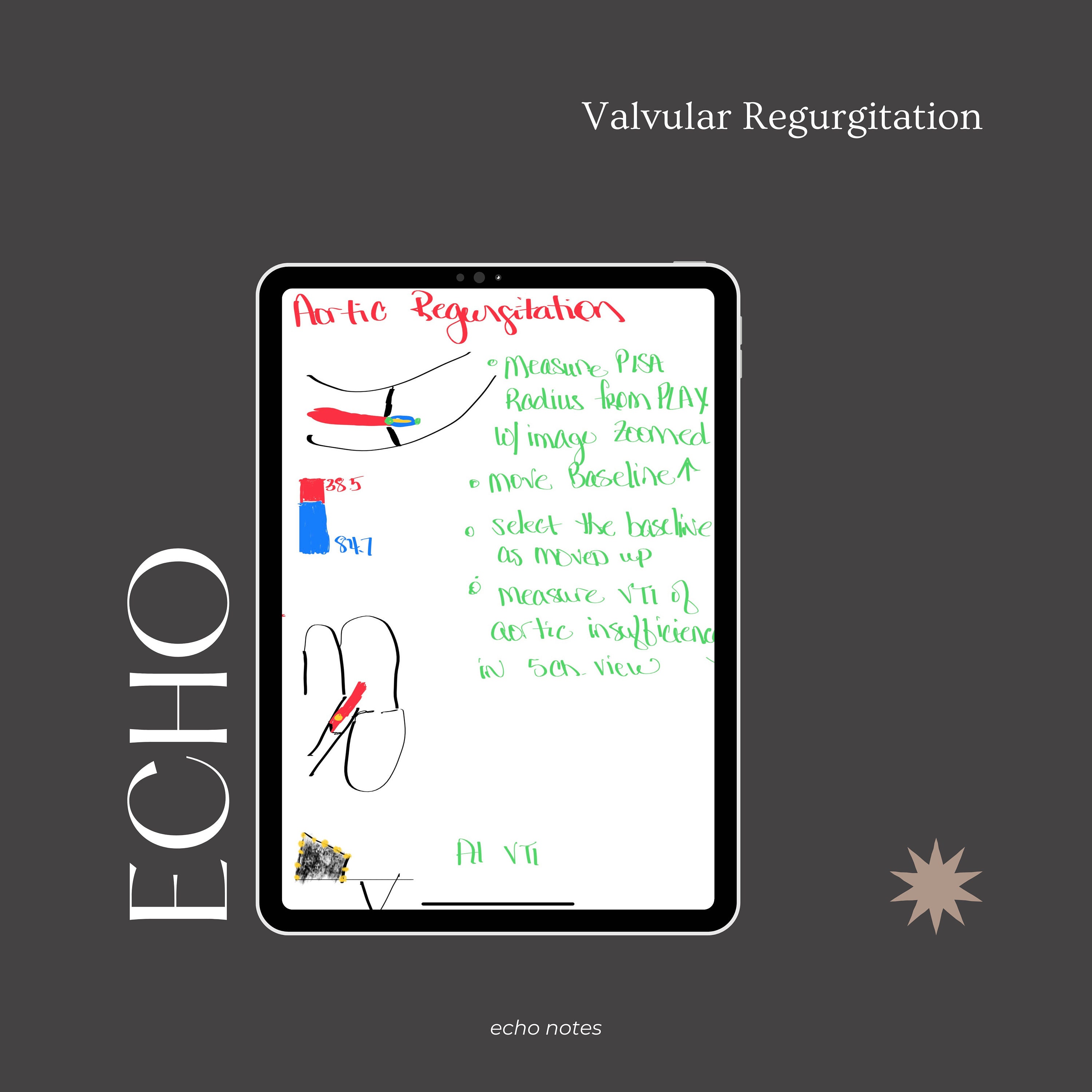 Sonography Notes Echocardiogram Study Guide Echo Tech Cheat Sheets ...
