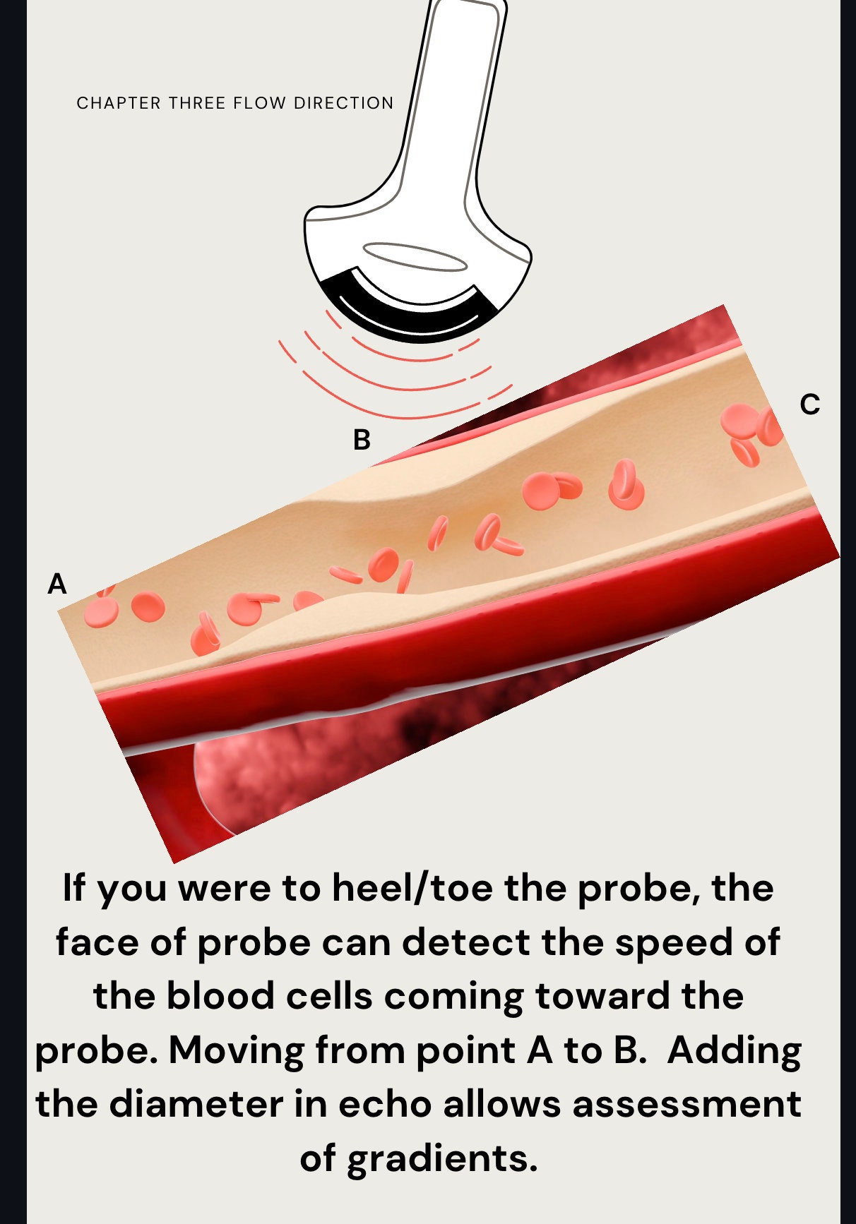 Vascular Ultrasound Color Doppler Ebook Ultrasound Study Guide Vascular ...