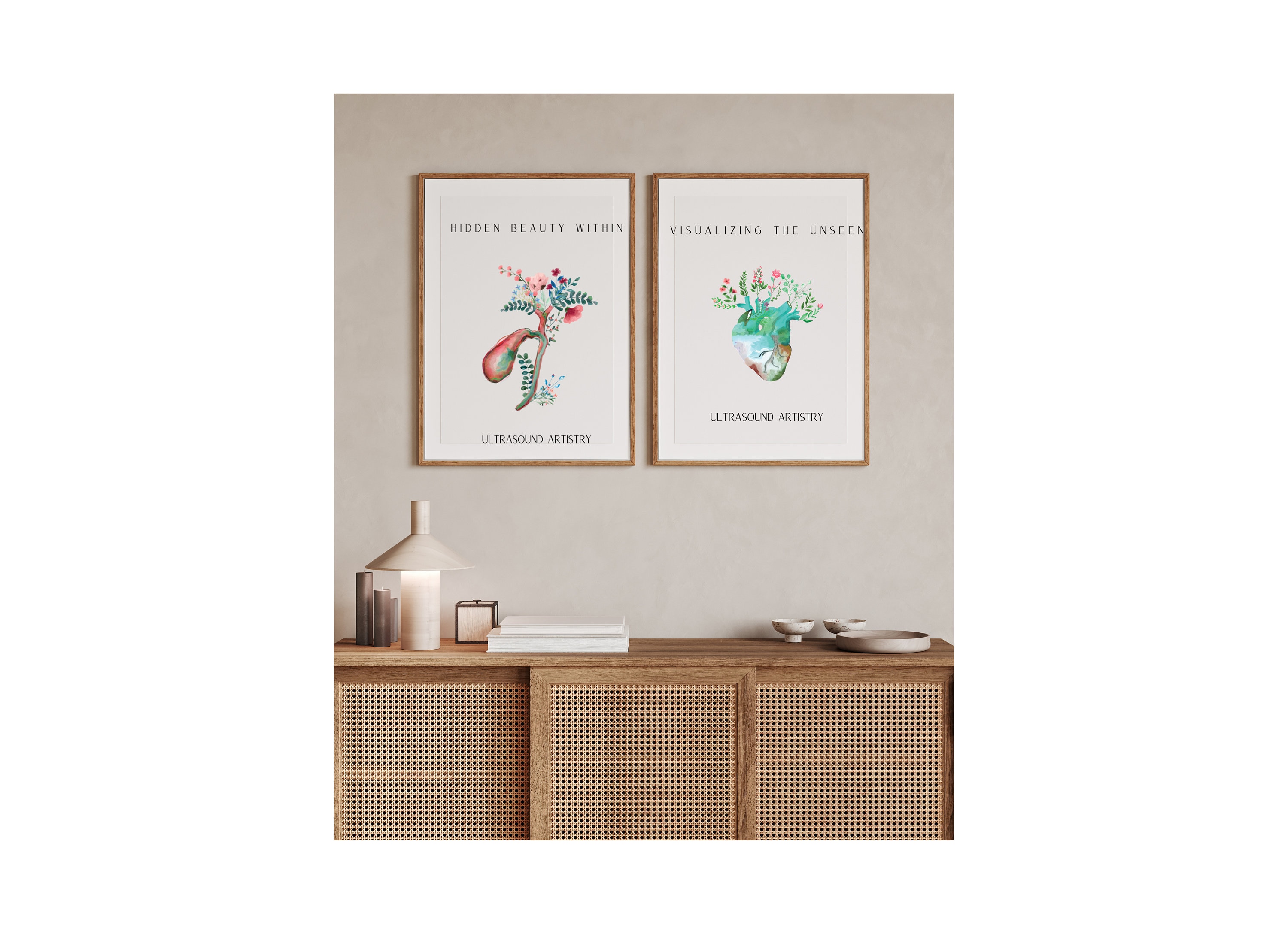 Sonography Wall Art Ultrasound Canvas 8x10 Ultrasound Tech Wall Decor ...