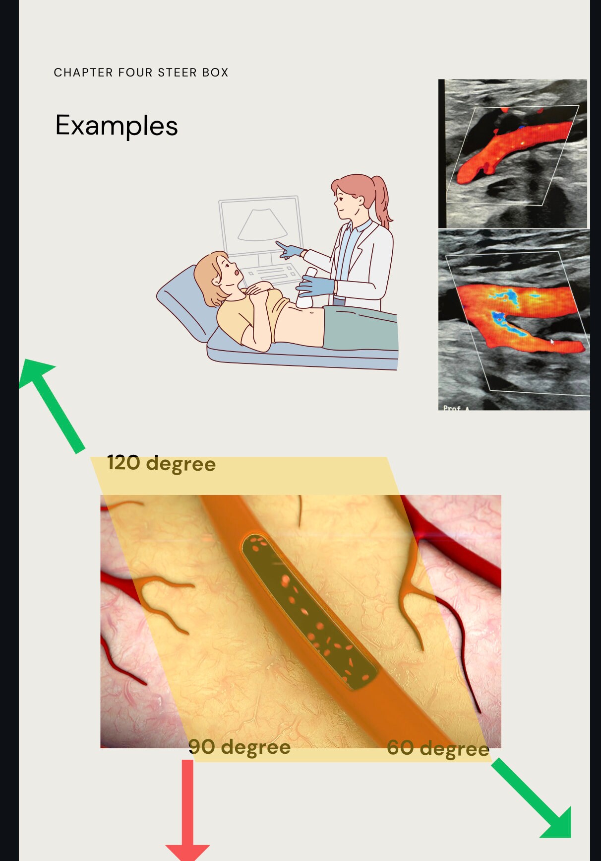 Vascular Ultrasound Color Doppler Ebook Ultrasound Study Guide Vascular ...