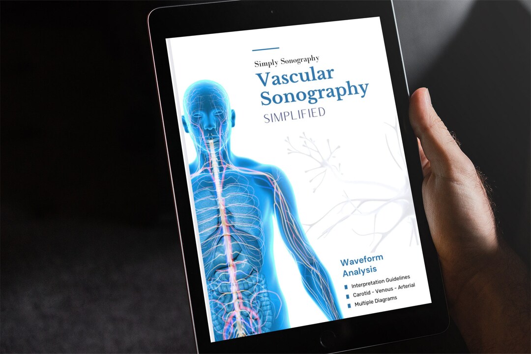 Vascular Sonography Made Simple E-book Vascular How-to-book Vascular ...