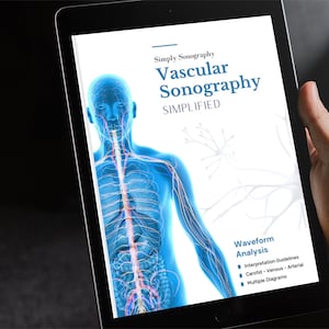Vascular Sonography Made Simple E-book Vascular How-to-book Vascular Study Guide Vascular for ...