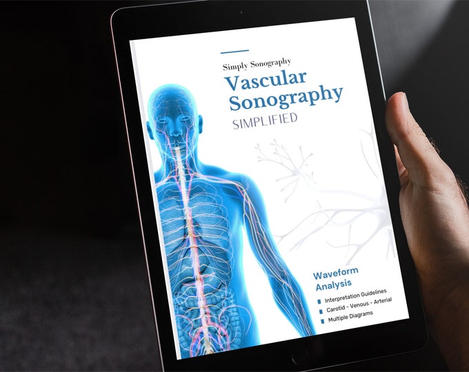 Vascular Sonography Made Simple E-book Vascular How-to-book Vascular ...