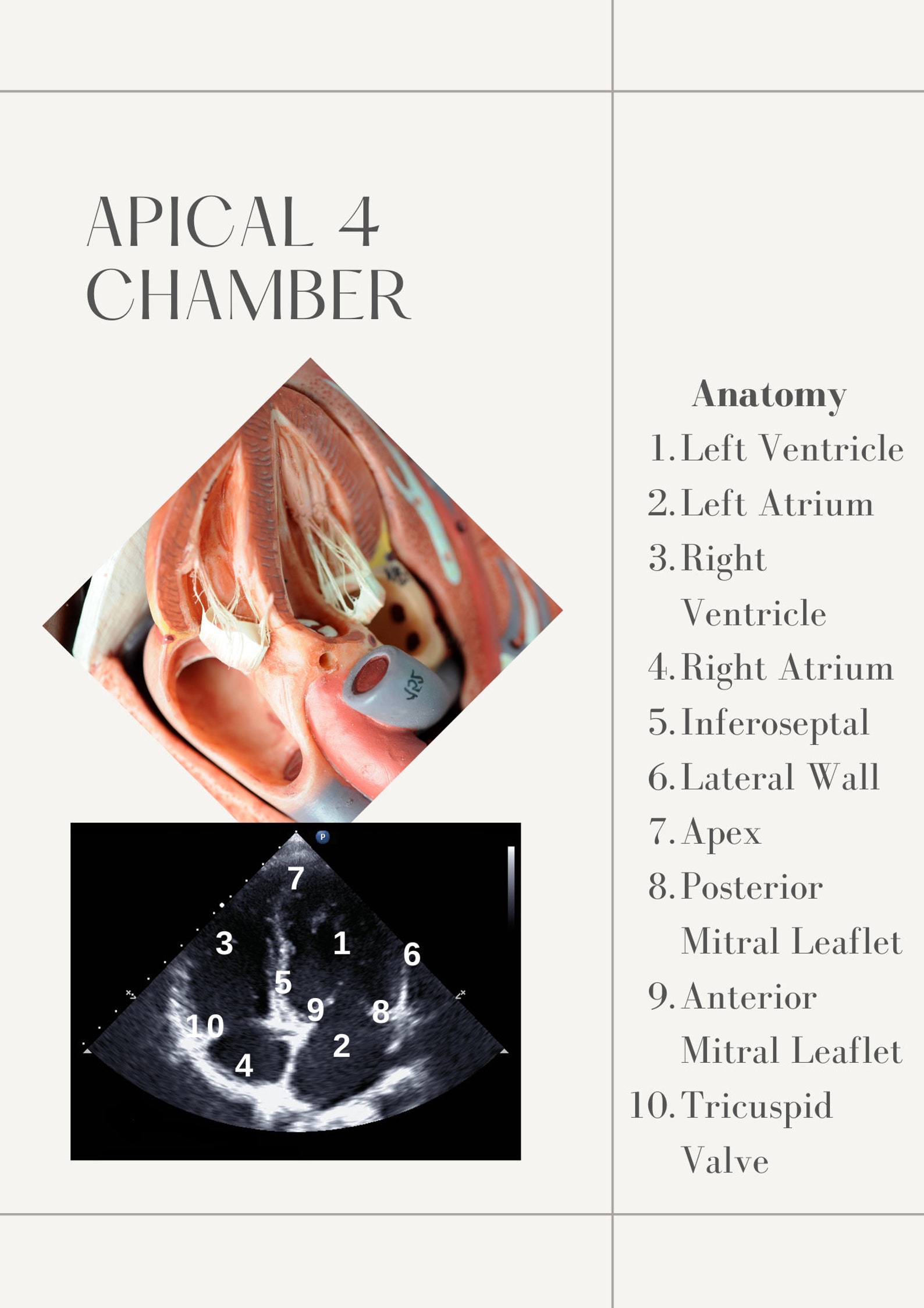 Echocardiography Made Simple Ebook How-to-guide Echo Book Echo Guide ...