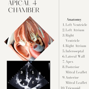 Echocardiography Made Simple Ebook How-to-guide Echo Book Echo Guide ...