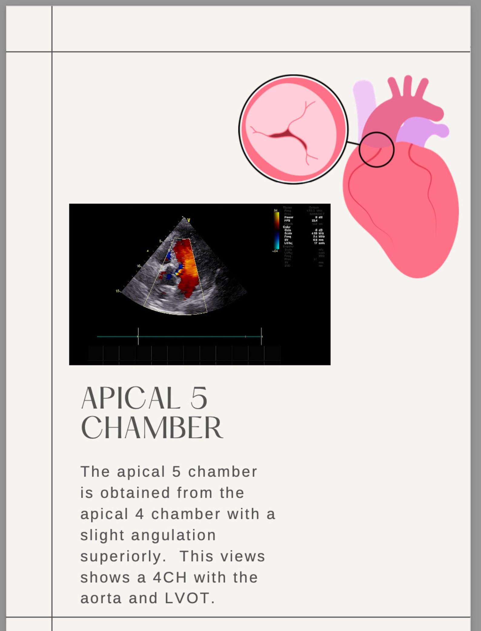 Echocardiography Beginners Guide/ Echo Ebook/ Echo Tech/ - Etsy