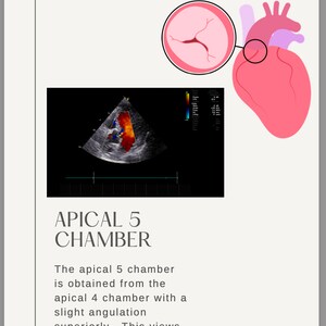Echocardiography Beginners Guide Echo Ebook Echo Tech Echocardiography ...