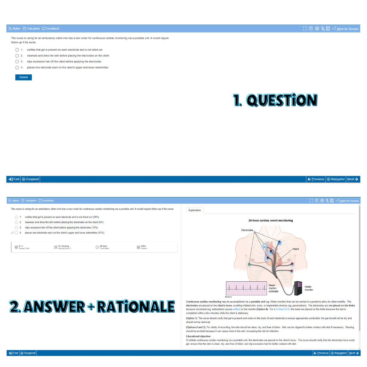 Uworld NCLEX-RN 2024 Cardiovascular Questions - Etsy