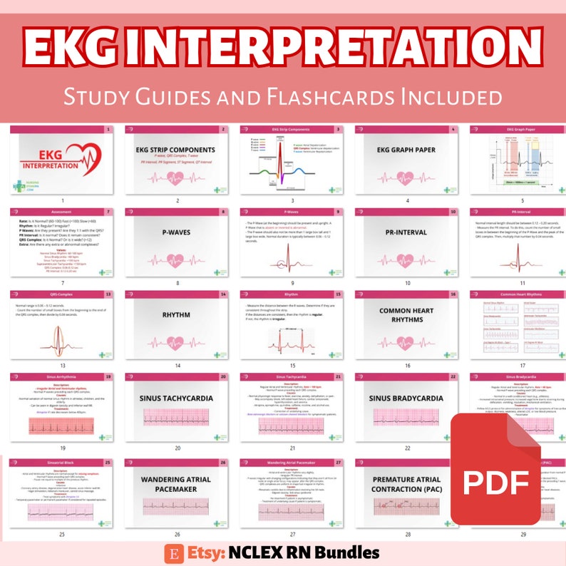 EKG & Dysrhythmia Interpretation + Flashcards PDF - Instant Download - Etsy