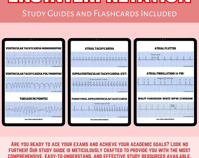 ECG Rhythms Flashcards | PDF - Etsy Australia