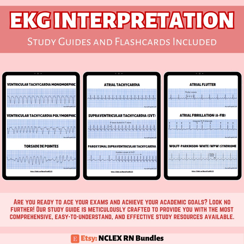 EKG & Dysrhythmia Interpretation + Flashcards PDF - Instant Download - Etsy