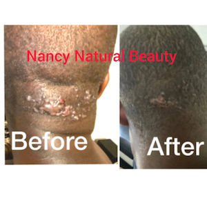 Razor Bump Stopper Cream: Natural Skin Treatment - Etsy