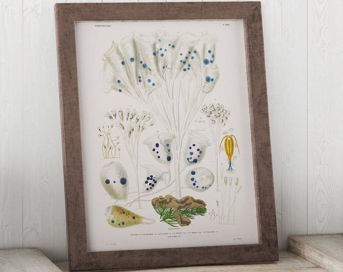 Microbiology Art Print: Epistylis Through the Microscope Science Print ...