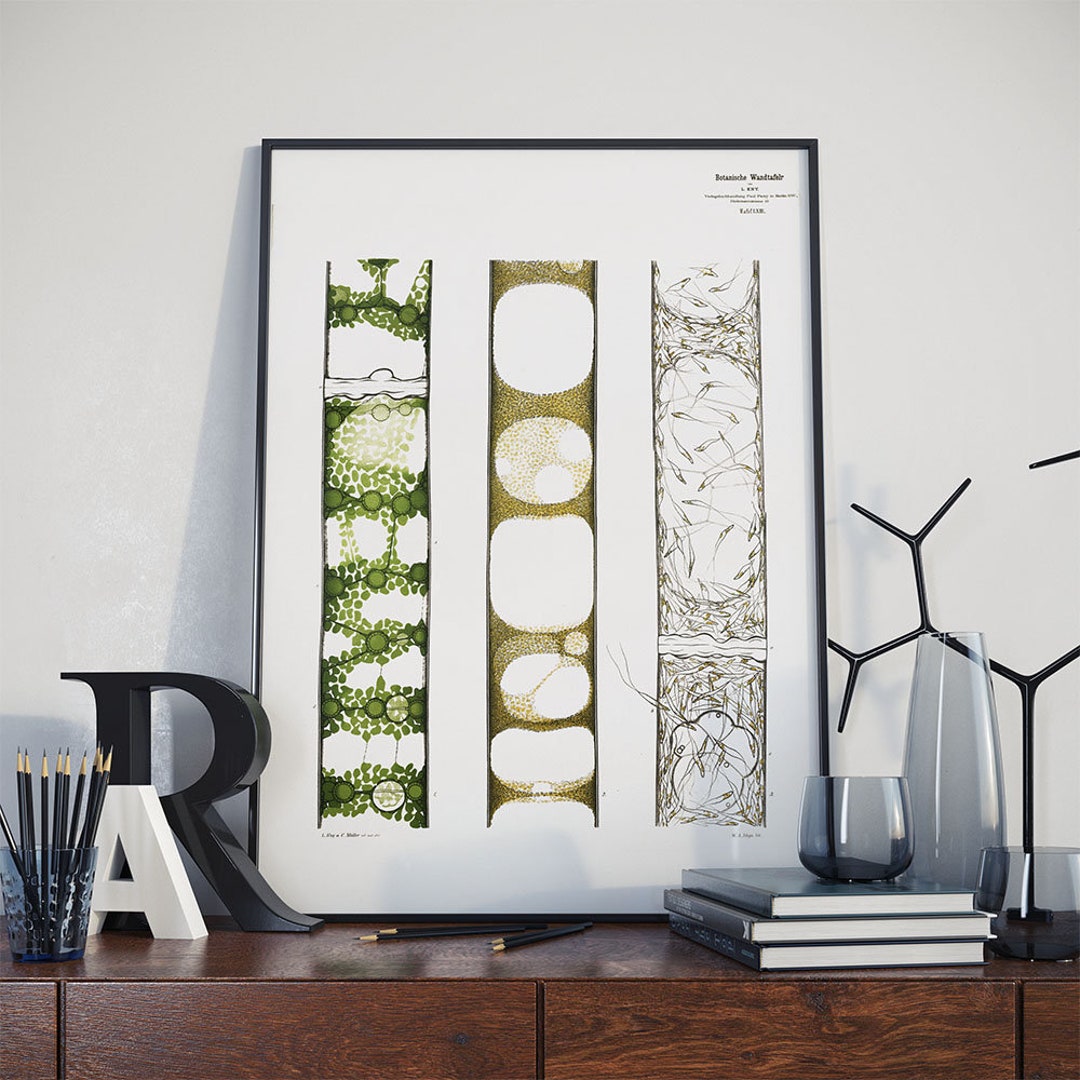 Microbiology Art Print: Sphaeroplea Annulina Biology Art Print ...