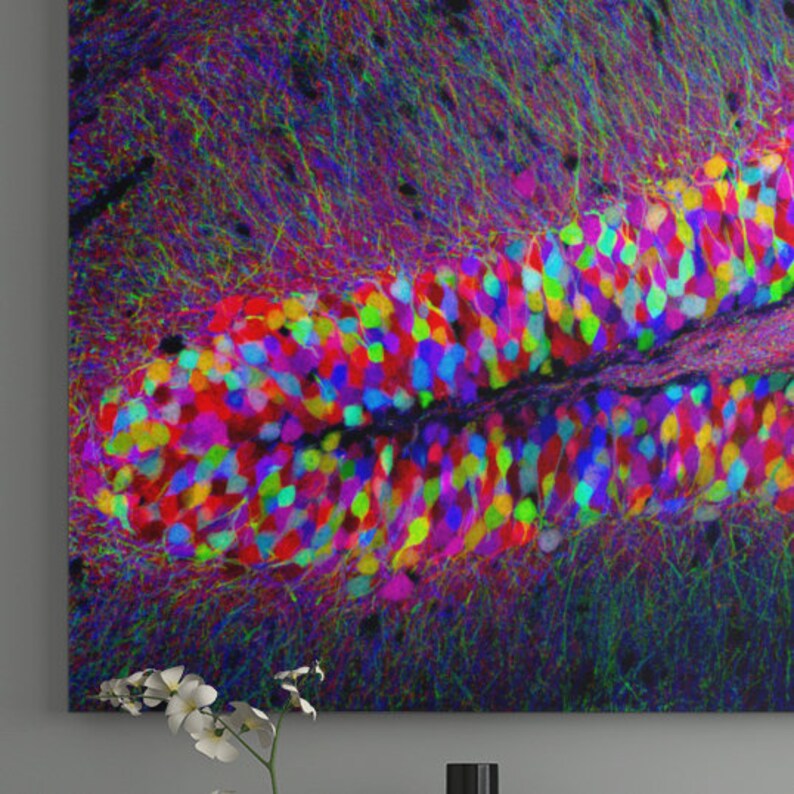 Neuron Art Print: Brainbow Hippocampus - Stunning Multicolor Neurology ...