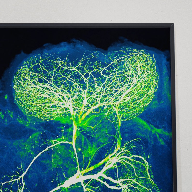 Neuron Art Print: Insect Brain Green and White Neuron by NICHD/N. Gupt ...