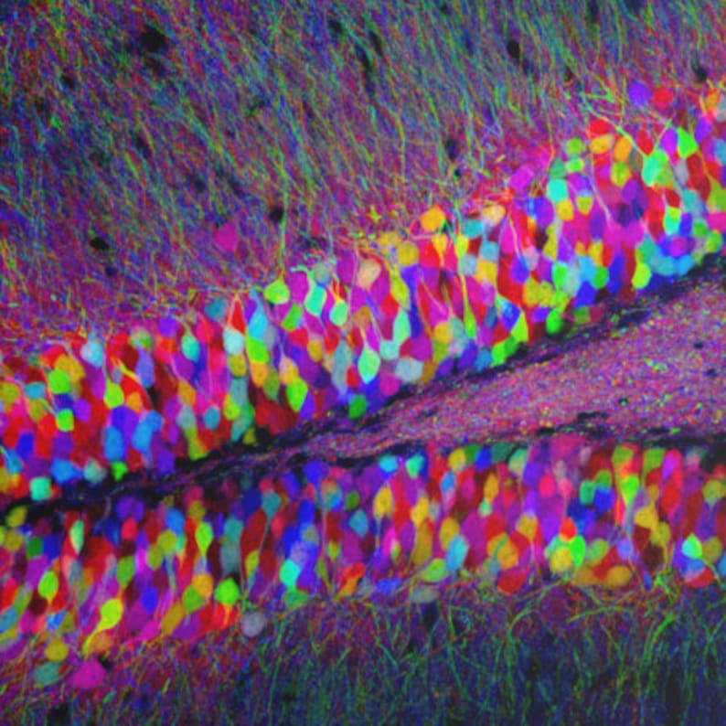 Neuron Art Print: Brainbow Hippocampus - Stunning Multicolor Neurology ...